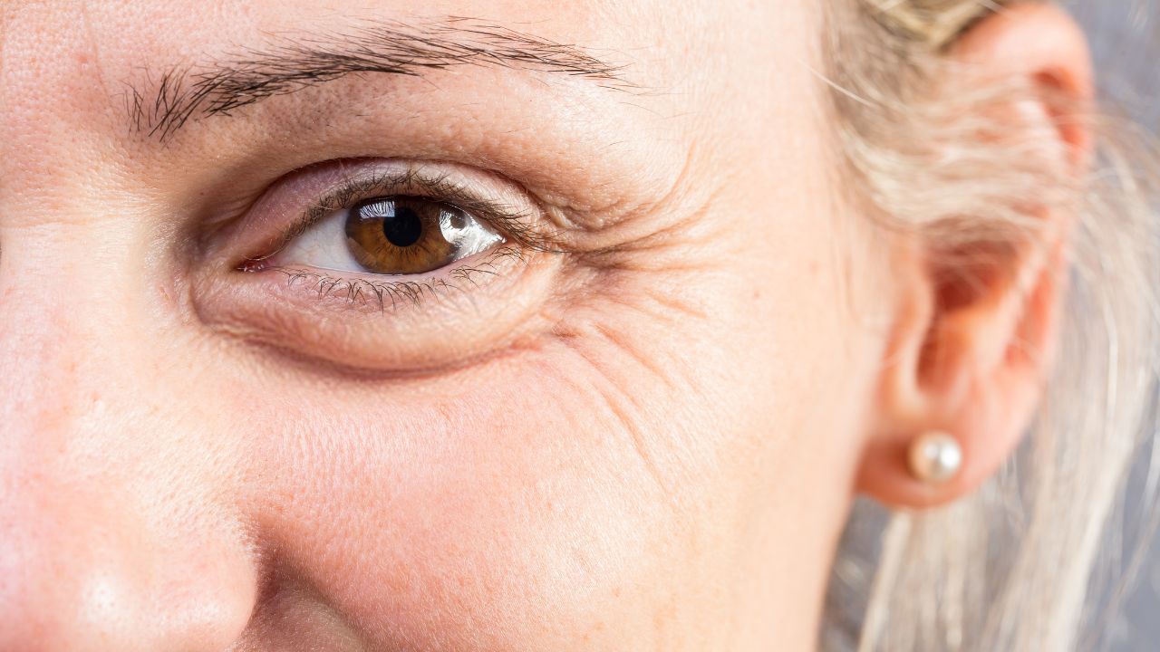 Causes Of Wrinkles & How To Prevent Them