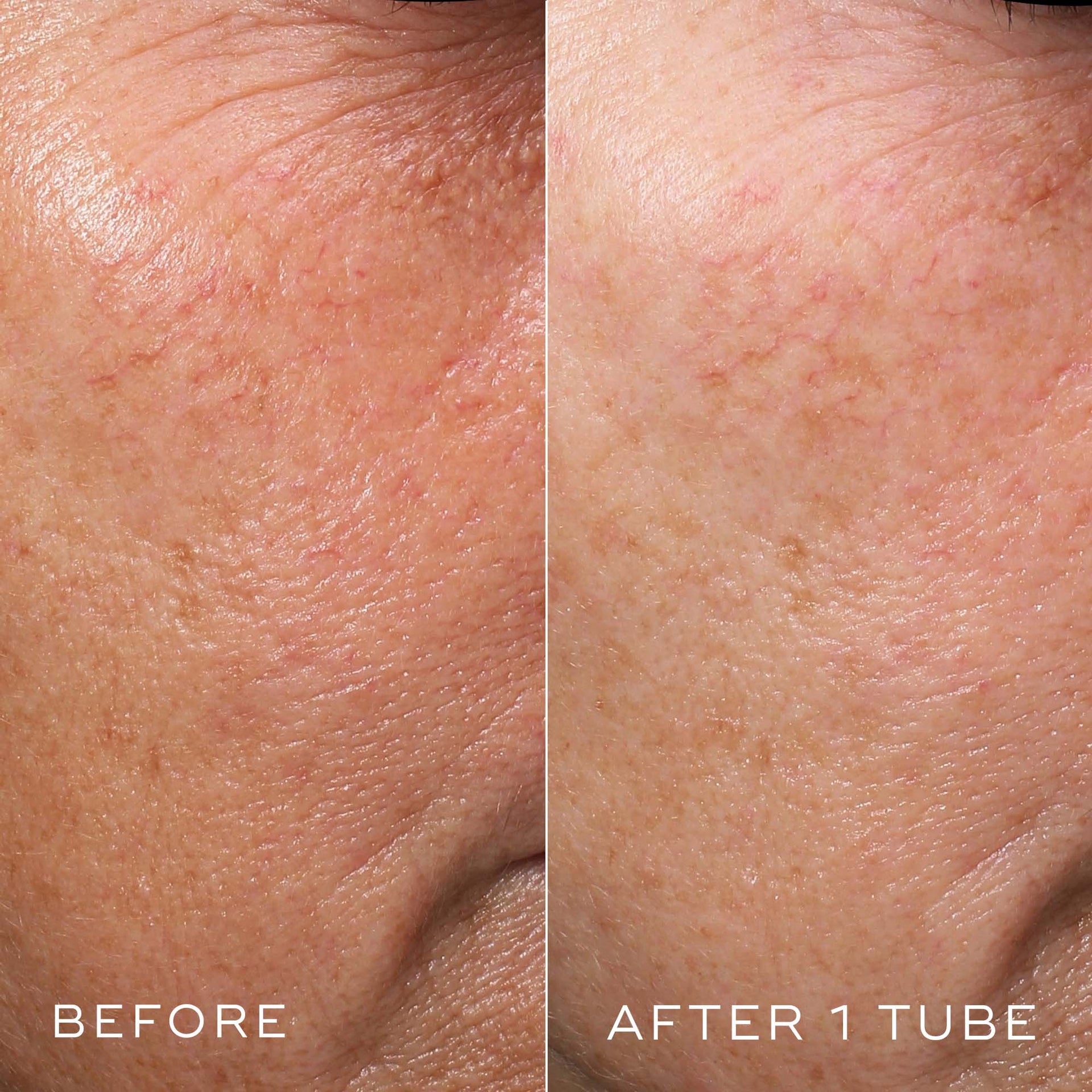 Crystal Retinal | Medik8