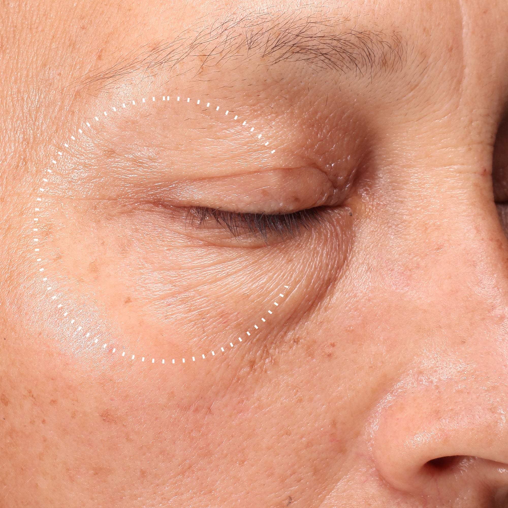 Crystal Retinal Ceramide Eye | Medik8